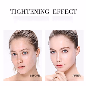 CYSMJDKJ Instalift Protein Thread Lifting Set, Soluble Protein Threads and Nano Gold Essence Combination, Absorbable Collagen Thread for Face Lift, Smoothes Fine Lines