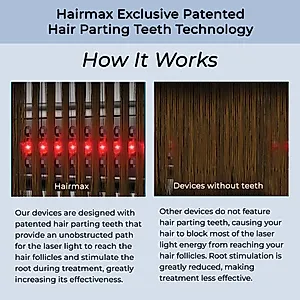 Hairmax Ultima 12 LaserComb - (FDA Cleared) Laser Hair Regrowth Treatment Device for Men & Women - Reverses Thinning Hair Loss - Red Light Therapy to Stimulate Hair Growth - Cordless Design