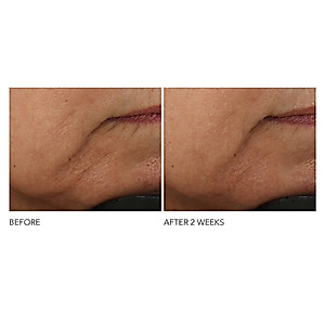 Dr Dennis Gross Advanced Retinol + Ferulic Intense Wrinkle Cream | Intensely Hydrating to Visibly Transform Skin and Repair the Moisture Barrier | 2 oz