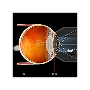 Volk G-4 Gonio Lens - Numerous Contact Type, Handle and Ring Size Options (G-4 High Mag Gonio, No Flange, Small Ring)