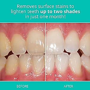 Opalescence Whitening Toothpaste for Sensitive Teeth - Oral Care, Mint Flavor, Gluten Free - 1 Pack