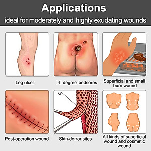 LotFancy Sacral Foam Dressing, 7"x 7", 5 Count, Silicone Foam Dressing, Wound Dressing with Border, Sacrum, Bed Sores, Pressure Ulcers Healing Bandage Pad, Highly Absorbent, Waterproof