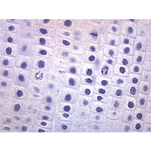 10pk Onion Mitosis, Prepared Microscope Slides - 75 x 25mm - Classroom Pack, 10 Slides in Storage Case - Plant Mitosis, Introductory Microscopy - Eisco Labs