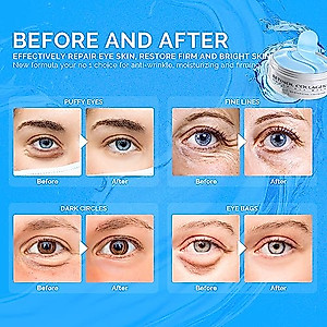 Enaskin Naturals Under Eye Patches for Dark Circles: 30 Pairs Retinol Collagen Eye Gels Mask - Reduce Wrinkles Puffy & Bags - Skin Treatment Pads - Anti Aging Moisturizer For Women (Blue)