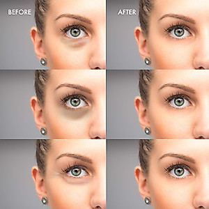 Aloe Vera Eye Treatment Mask (30 Pairs) Reduces Puffiness, Wrinkles, Puffy and Bags Under Eyes, Lightens Dark Circles, Undereye Patches Moisturizes and Anti Aging Skin, Hydrogel Pads with Collagen