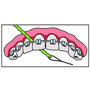 IDontix Brace X-Floss, Green