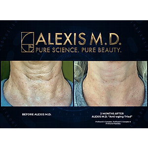 ALEXIS M.D. Profound Eye Cream | 30ml | 1oz