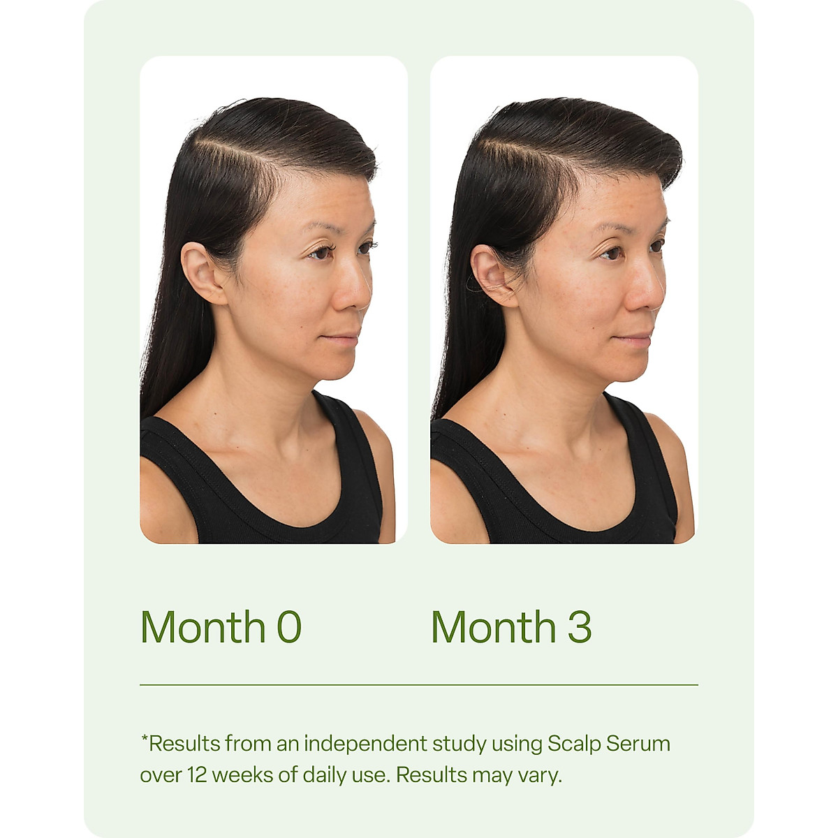 Divi Hair Scalp Serum for Women and Men - Revitalize and Balance Your Scalp - Improves Appearance of Thinning Hair, Nourishes the Scalp and Helps Remove Product and Oil Buildup, 100ml