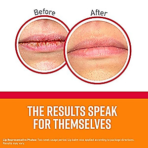 O'Keeffe's Medicated Lip Repair Seal & Heal Lip Protectant, Stick, (Pack of 2)