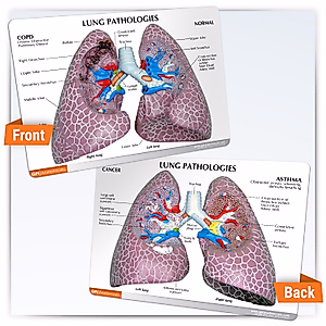 Lung Model Set | Human Body Anatomy Replica of Lung Cancer for Doctors Office Educational Tool | GPI Anatomicals
