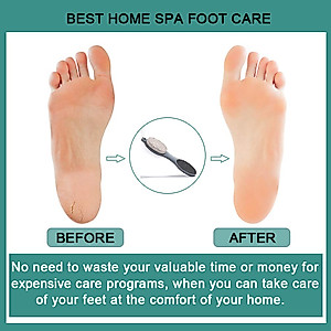 CAREHOOD Foot File Callus Remover - Multi Purpose 4 in 1 Feet Pedicure Tools with Foot Scrubber, Pumice Stone, Foot Rasp and Sand Paper for Home Foot Care (Grey Pedicure Foot File)