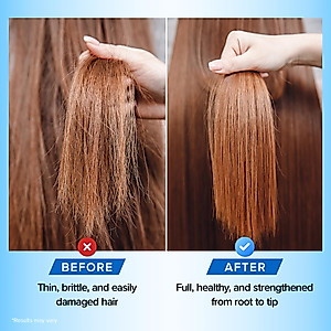 DermaChange Biotin Shampoo and Conditioner Set - Hair Growth Shampoo and Conditioner for Men & Women - Shampoo Conditioner for Dry, Damage & thinning hair with Tea Tree, Manuka Honey & Rosemary 16oz