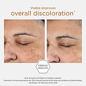 NEOSTRATA Illuminating Serum Tone Correcting Concentrate with NeoGlucosamine Niacinamide and Licorice Extract, 1 fl. oz.