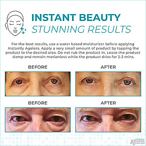 Instantly Ageless Facelift in A Box - 1 Box of 25 Vials
