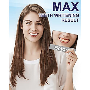 MySmile Teeth Whitening Kit Enhanced Teeth Whitener Flagship Version,10 Min 6 Month Supply Non-Sensitive Teeth Whitening Pen, Helps to Remove Stains from Coffee, Smoking, Wine, Soda, Tea