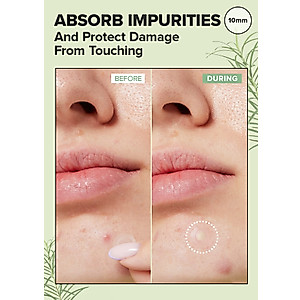 I DEW CARE Hydrocolloid Acne Pimple Patch - Timeout Blemish Original + Timeout Blemish Plus Bundle