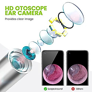 Ear Wax Removal Camera for Android Phone Tablet, Mac, PC, 1280x720HD Smart Visual Ear Cleaner with Camera Tool Kit, at Home Ear Infection Detector Ear Wax Remover Otoscope with Light