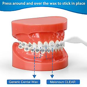 Braces Wax - 10 Pack (50 Precut Orthowax Strips). Flavorless & Mint. Separate Cases, a Storage Box & 2 Applicator Tools - Food-Grade Premium Wax for Braces Wearer- Stick Better(w/Aloe Vera+Vitamin E)