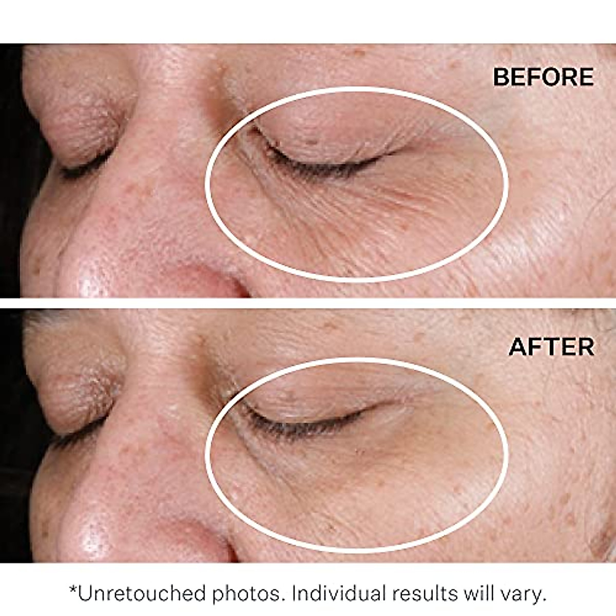 StriVectin High-Potency Wrinkle Filler, 0.5 Fl Oz