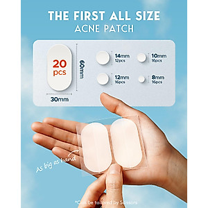 LitBear Large Acne Pimple Patches, 5 Sizes 80 Patches for Large Breakouts, Acne Patches for Face, Chin or Body, Acne Spot Patch with Tea Tree & Calendula Oil, Hydrocolloid Bandages for Acne Skin