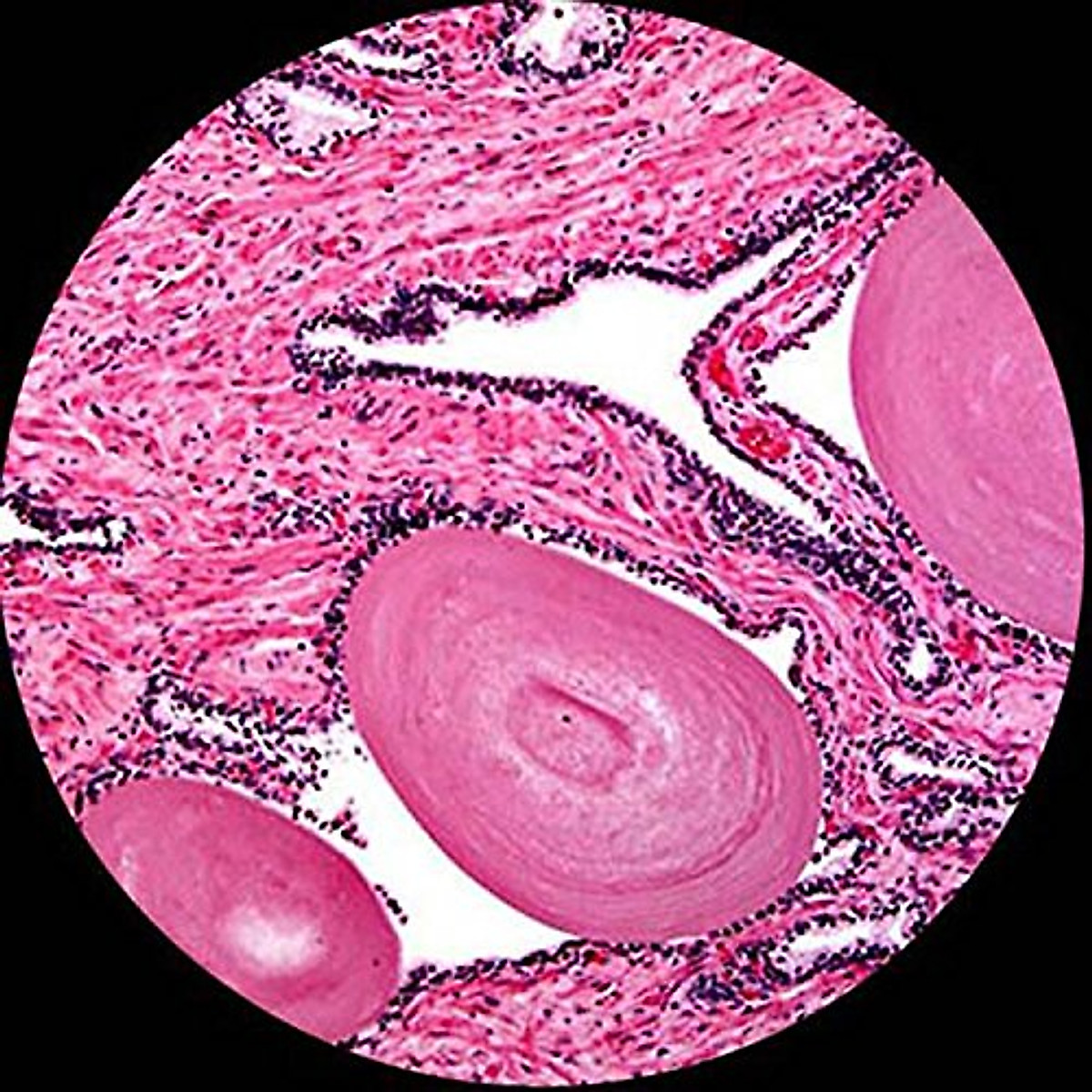 AmScope PS200 Basic Biology Prepared Slide Set for Student and Homeschool Use, Set of 200 Prepared Glass Slides, Includes Fitted Wooden Storage Box