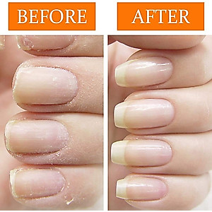 Nail Tek Repairs Damaged Nails kit.Intensive Therapy(.5OZ),Foundation(.5OZ)& Renew(.48OZ)