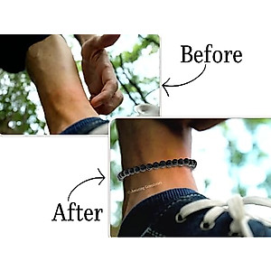 Mosquito Repellent Bracelets and Anklet Repeller with Essential Oil Refill Container - Lava Stone Camping Essentials Mosquito Bracelets for Adults Bug Repellent Bracelets - Pack of 2 Bug Bands