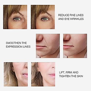 RF Beauty Device | Home RF Lifting | Wrinkle Removal | Anti Aging | Skin Care - Increase Collagen & Absorption - MLAY Professional Radio Frequency Skin Tightening for Face and Body - Salon Effects