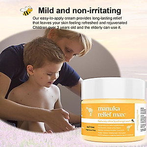 UEUEKOKO Eczema Psoriasis Manuka Relief Honey Cream, Hand Foot, Tinea Versicolor, Itchy Feet, Butt, Anal Itch, Scalp Dandruff, Bee Sting, Bites, Boil Cyst, Armpit, Adults Kids, Hidradenitis Treat