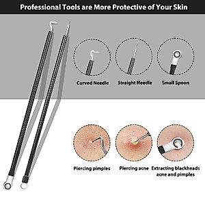Glamne Blackhead Remover Pimple Popper Kit Acne Comedone Extractor Blemish Extraction Popping Tools (Black)