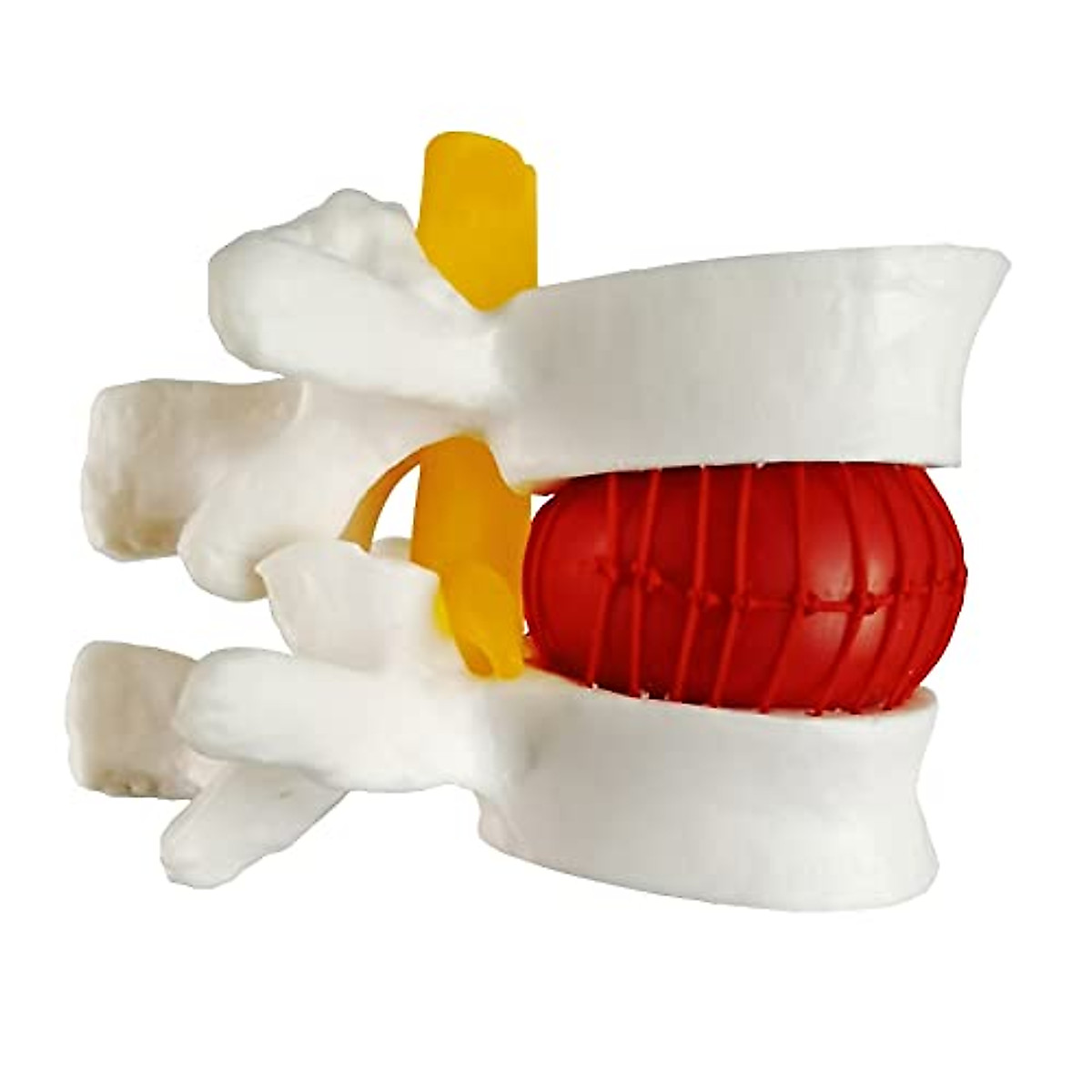 2023 New Human Anatomical Lumbar Herniation Model, Vertebrae Degenerative Lumbar Human Spine Model 1PCS,Lumbar Spine Model for Teaching & Learning - Excellent Way for Demonstrating Disc