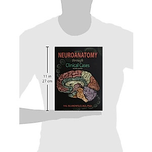 Neuroanatomy through Clinical Cases