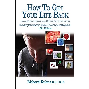 How to Get Your Life Back From Morgellons and Other Skin Parasites Limited Edit