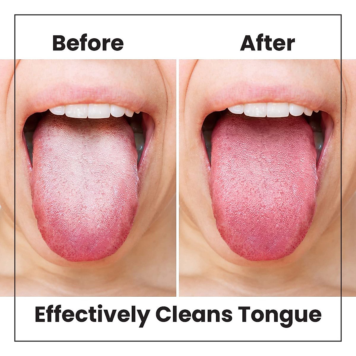 Lindo Eco-Friendly Tongue Cleaners, Tongue Scrapers, Oral Care Cleaners, Reduce Bad Breath, Soft Silicone Bristles, Natural, Vegan, 2 Pack