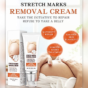 Stretch Mark Cream, Scar Cream Removal Cream Scars Essence Stretch Mark Repair Cream Stretch Scars Remove Acne Cream Stretch Mark Treatment Maternity Repair