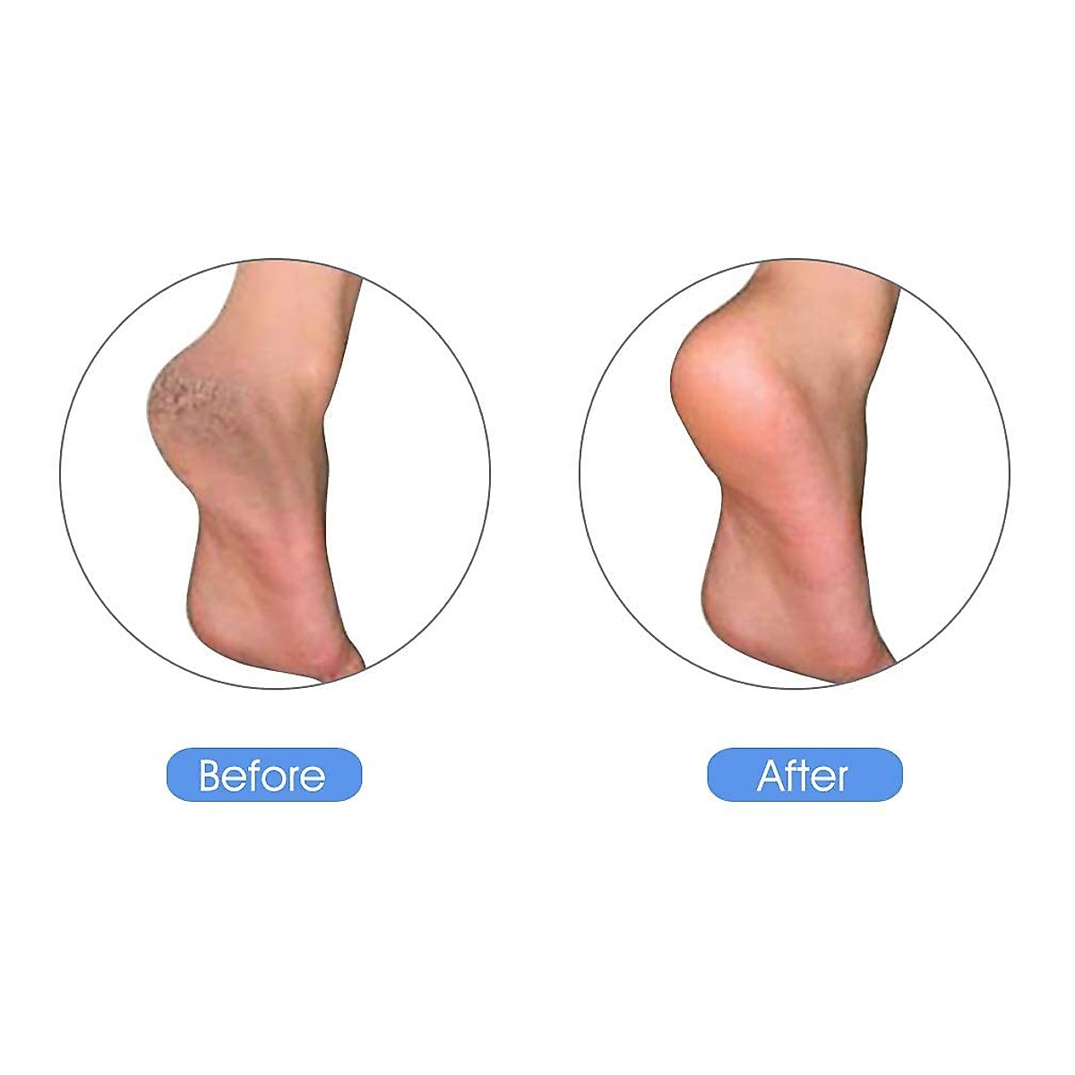 KuuCare Pumice Stone for Feet, Natural Earth Lava Pumice Stone - Foot File Callus Remover for Feet Heels, Pedicure Exfoliator for Dead Skin, Hard Skin and Foot Scrubber