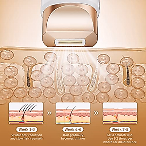 Aopvui Laser Hair Removal for Women and Men, IPL Permanent Hair Removal 999900 Flashes Hair Remover Device for Whole Body Use