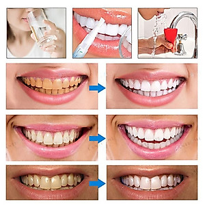 3Pcs Teeth Whitening Pen,Teeth Whitening Gel,Teeth Whitening Essence Pen,Intensive Teeth Stain Remover,Reduce Yellowing Oral Care for Women & Men.