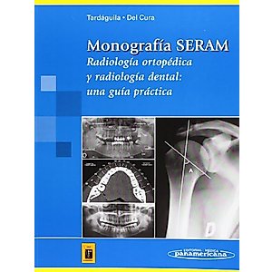 Monografía SERAM: Radiología ortopédica y radiología dental: una guía práctica (Tardáguila / Del Cura) (Spanish Edition)