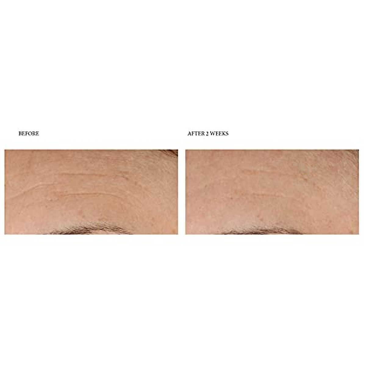 Dr Dennis Gross B³Adaptive SuperFoods™ Stress Repair Face Cream. For Dehydration, Redness, and Worry Lines, 2.0 fl oz