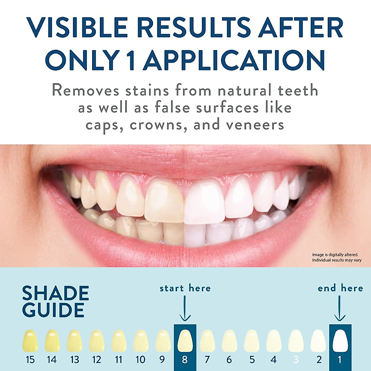 LOVE YOUR TEETH Whitening Device Kit - Teeth Whitening System with LED Blue Light Mouthpiece - Home Teeth Whitener - Clinically Tested Whitening Kit for Stained Teeth - 7 Shades Whiter Teeth in 7 Days