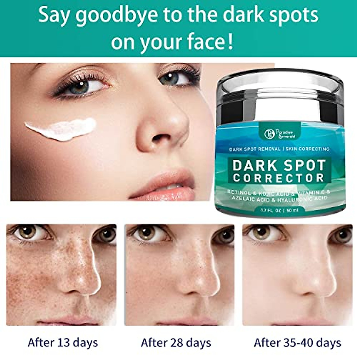 Paradise Emerald Dark Spot Remover for Face, Hyperpigmentation Treatment, Melasma, Freckle, Sun Spots Removal for All Skin Types Dark Spot Corrector for Men and Women
