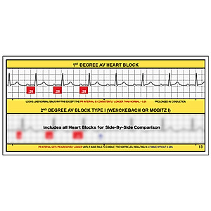 R-CAT for Arrhythmias EKG Pocket Reference Guide – Great Study Card for EKG Interpretation - ACLS and PALS Training – Cardiac Rhythm Interpretation Made Easy