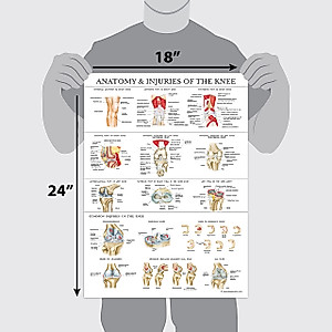 Palace Learning Laminated Anatomy and Injuries of the Knee Poster - Knee Joint Anatomical Chart - 18" x 24"