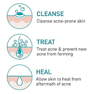 CeraVe Acne Treatment Face Wash and Retinol Serum Bundle | Contains One Acne Foaming Cream Cleanser (5 Ounce) and One Brightening Facial Serum for Post-Acne Marks and Pores (1 Ounce)