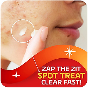 Asepxia Acne Treatment Cream for Face, 2% salicylic acid, Rapid Maximum Strength Acne Treatment, Clears Pimples and Blackheads, Prevents New Acne and Controls Excess Oil, 1 oz