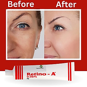 Retinol Night Moisturizer Cream 0.05% Jojoba Oil, Tea Extract, Vitamin E Firming Cream I Anti Aging, Retinol Moisturizer & Wrinkle Cream for Women, Anti Wrinkle Face 20g