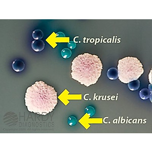 HardyCHROM Candida, Chromogenic Medium for C. Tropicalis, Krusei, and Albicans; 15x100mm Plate, Order by The Package of 10, by Hardy Diagnostics
