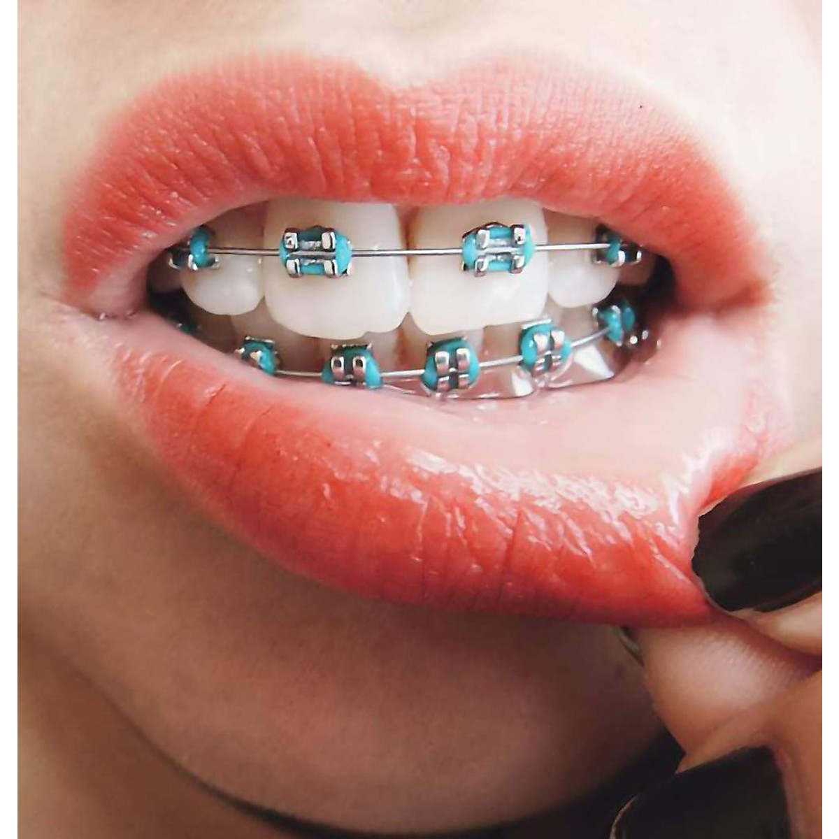 Dental Orthodontic Ligature Ties and Orthodontic Ligature Gun Tools Teeth Orthodontic Ligature Ring Rubber Bands Multi-Color(1040 Pcs/Bag)