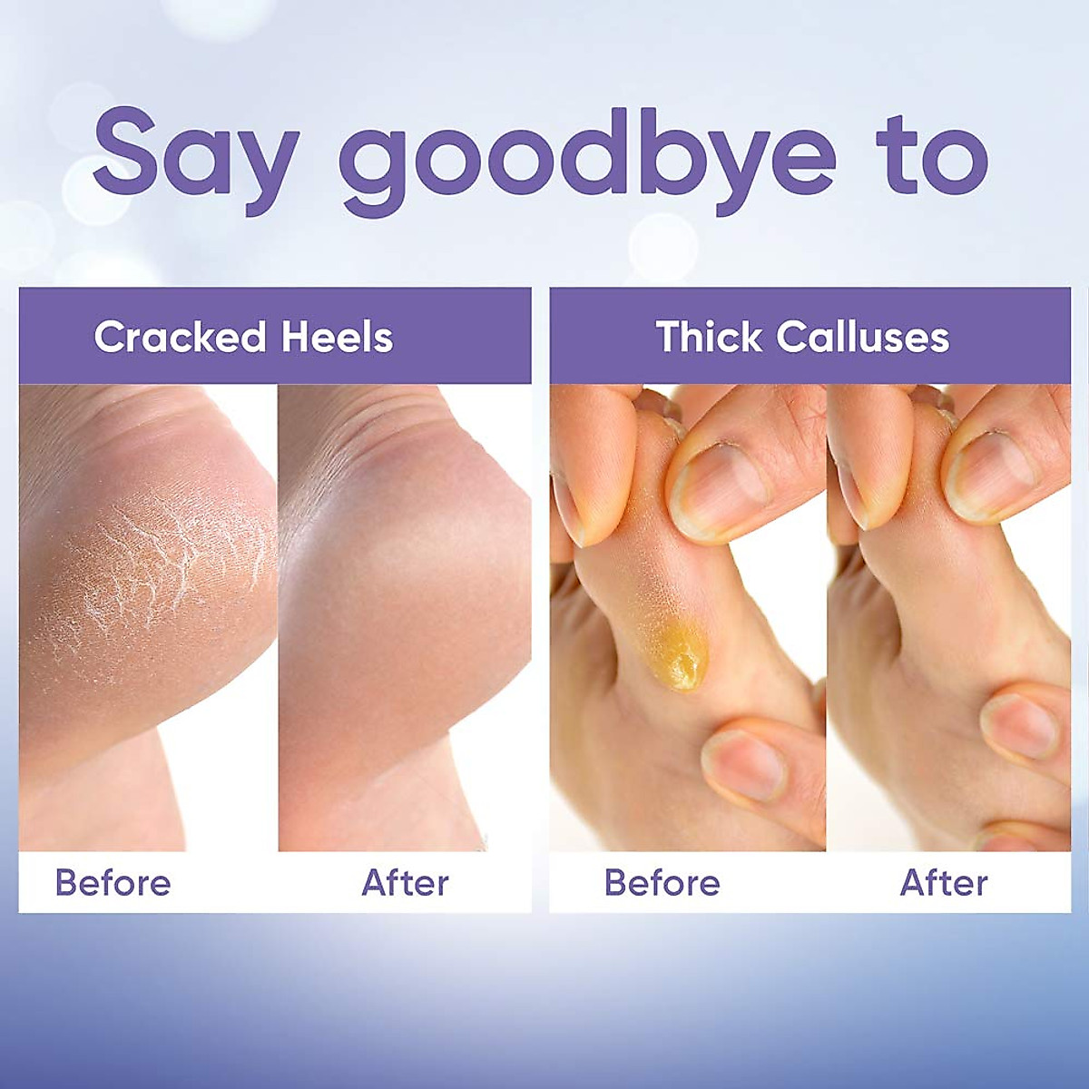 ﻿Foot Peel Mask (2 Pairs) - Foot Mask for Baby soft skin - Remove Dead Skin | Foot Spa Foot Care for women Peel Mask with Lavender and Aloe Vera Gel for Men and Women Feet Peeling Mask Exfoliating